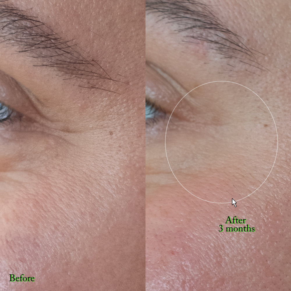 Evidence – unplain